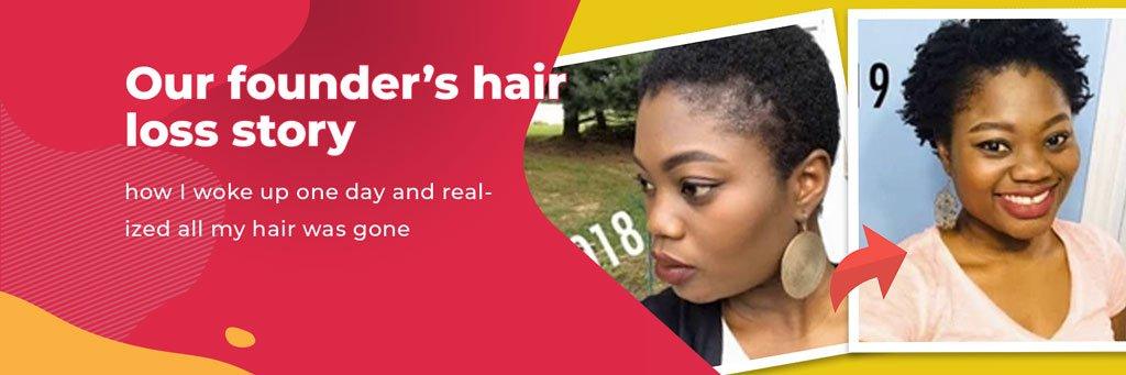 Our founders hair loss story....